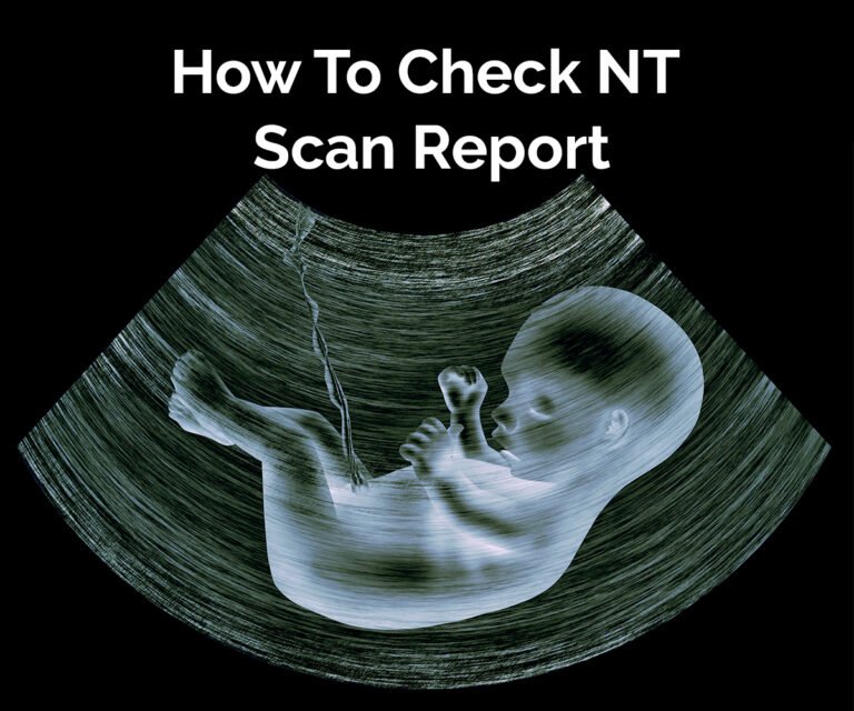 When is a nuchal translucency scan done?